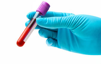 Blood Tests: How to prepare your child - Utah Valley Pediatrics